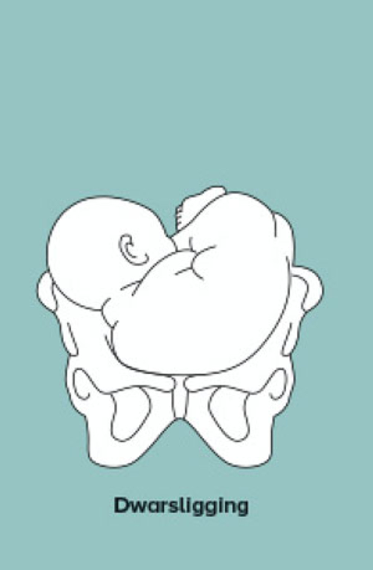 Ligging van je baby in de buik - Ouders van Nu