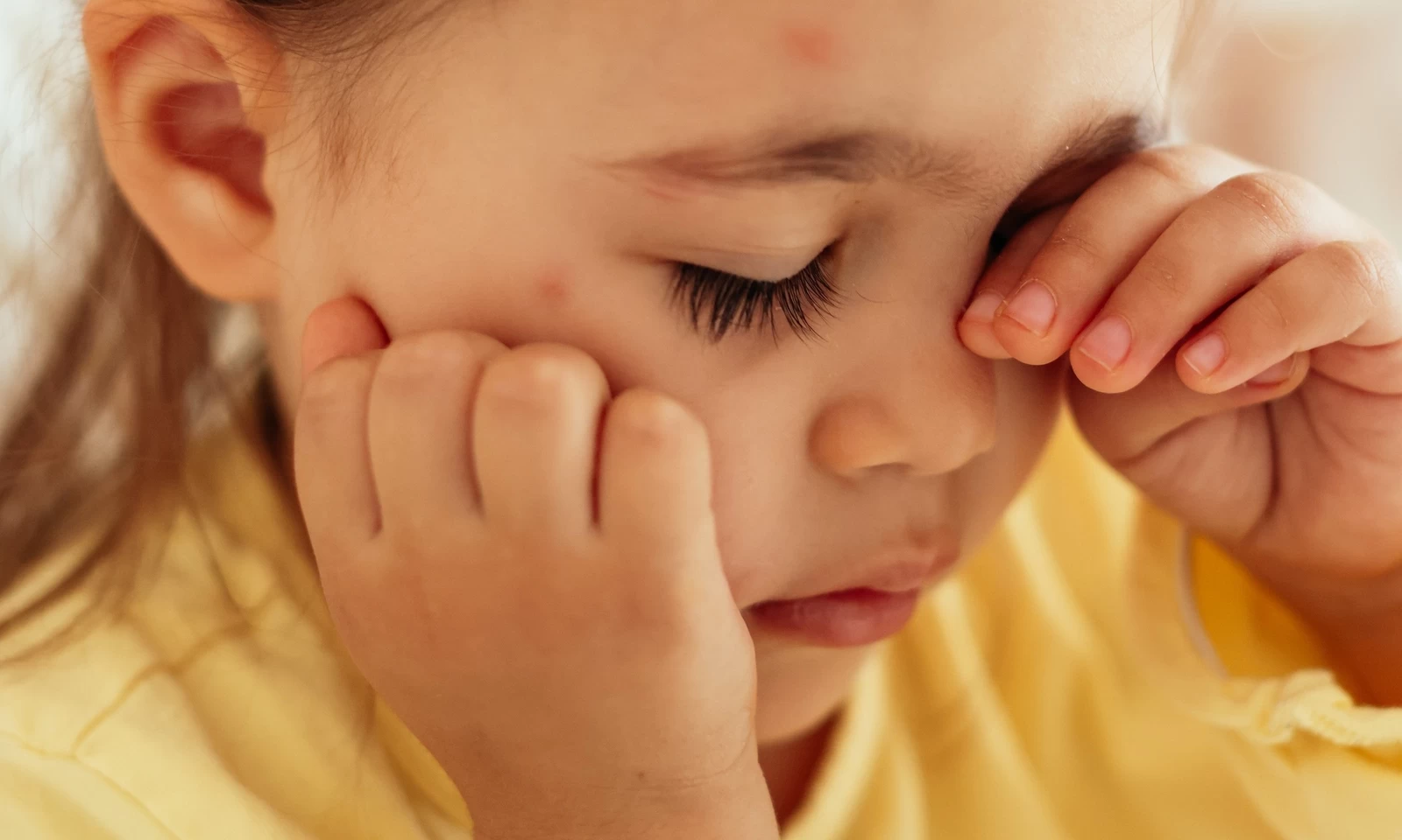 Mazelen bij baby, kind en zwangerschap