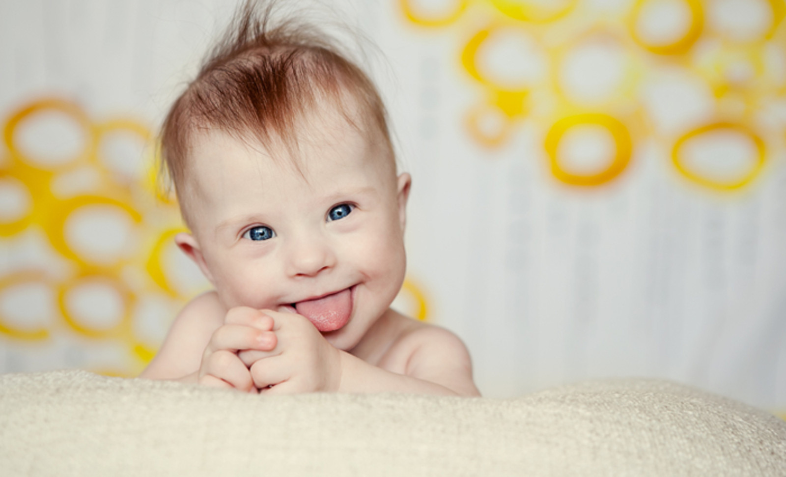 Syndroom van Down - Ouders van Nu